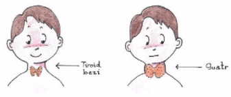 Guatr – Çocuk Endokrinolojisi ve Diyabet Derneği